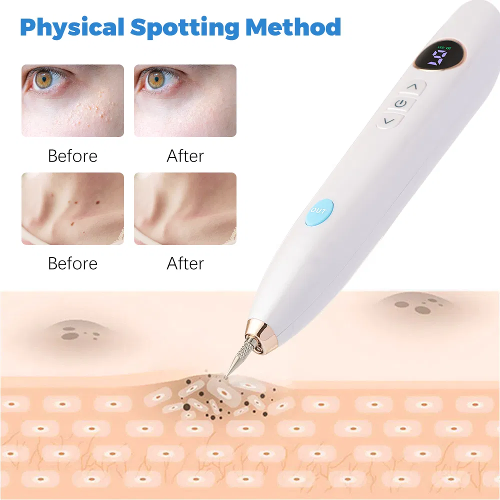 Get Laser Skin Tag Remover Face Mole Remove Plasma Pen Freckle Removal ...